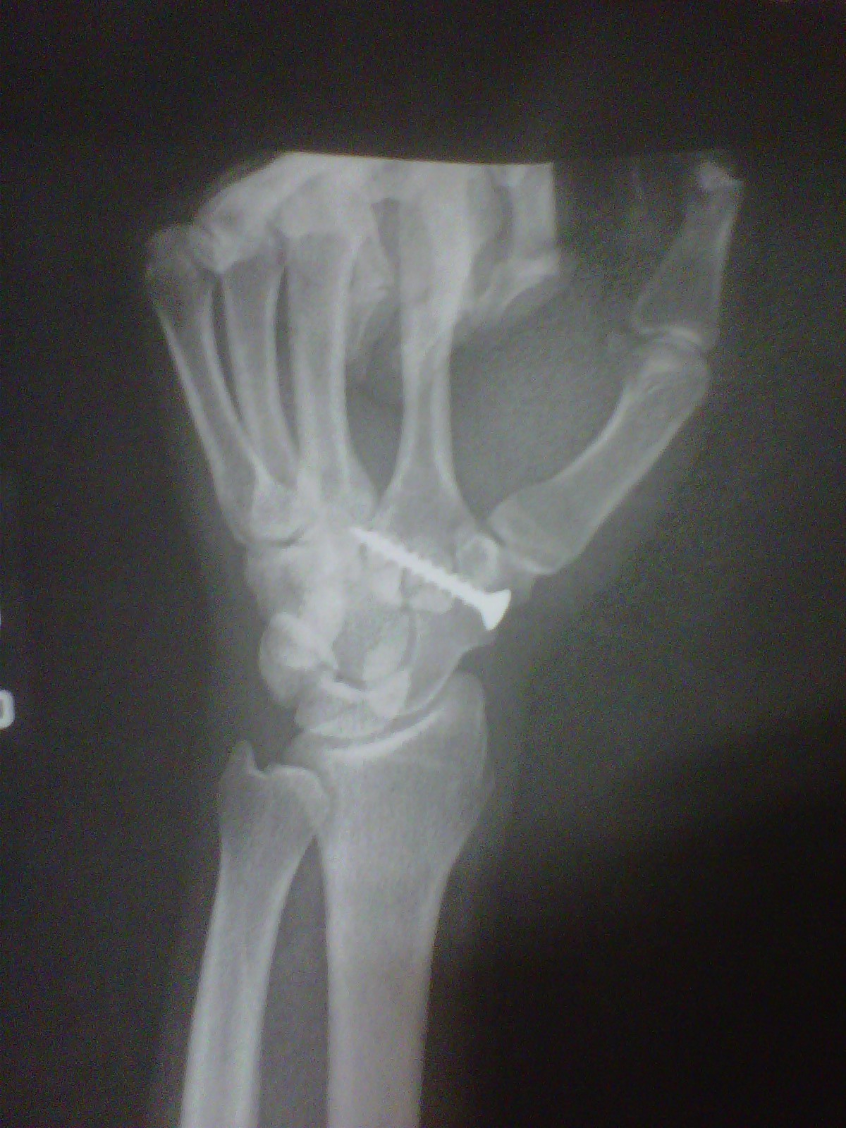 Screw That!